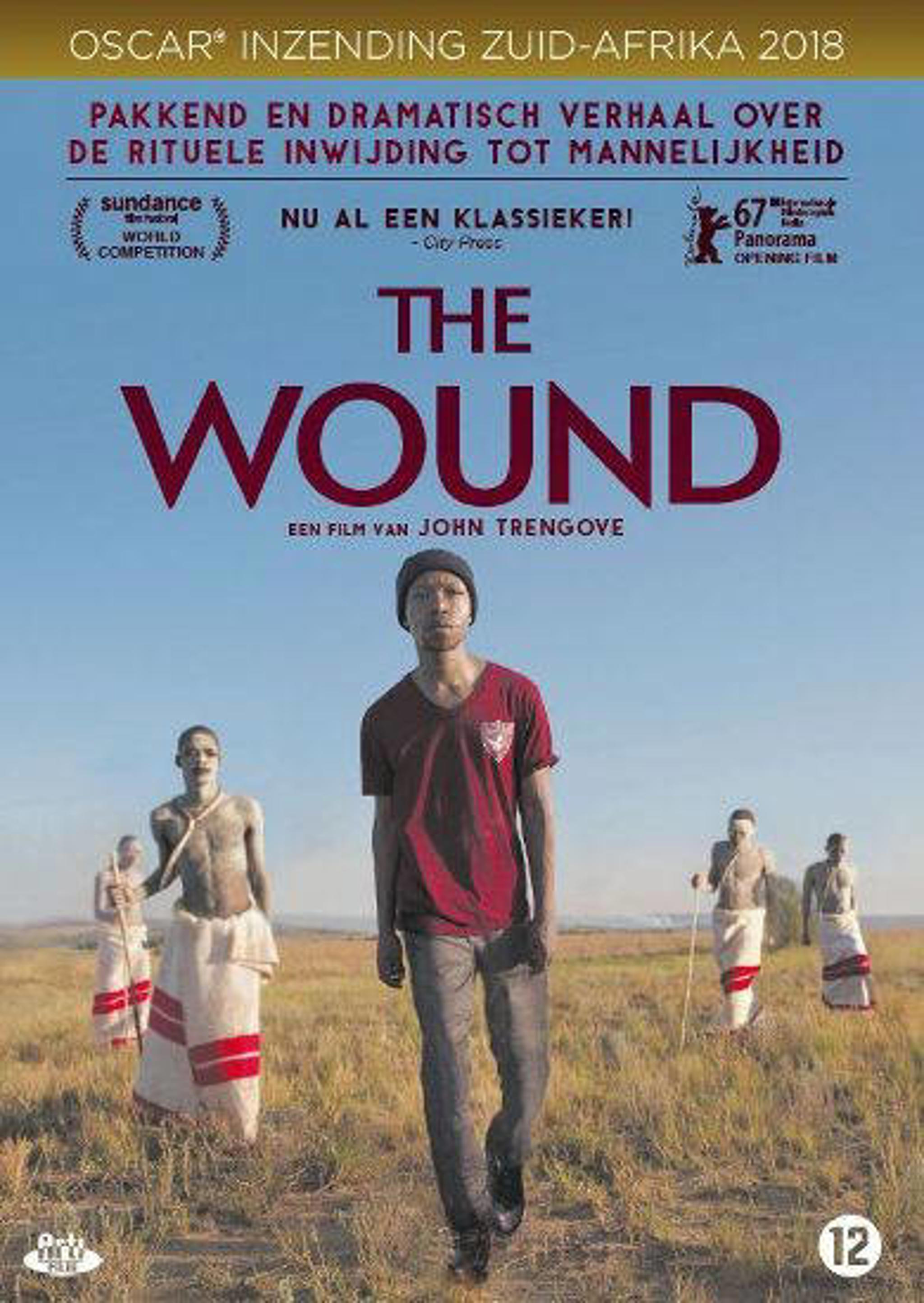 Wound (DVD) kopen? | Morgen in huis | wehkamp